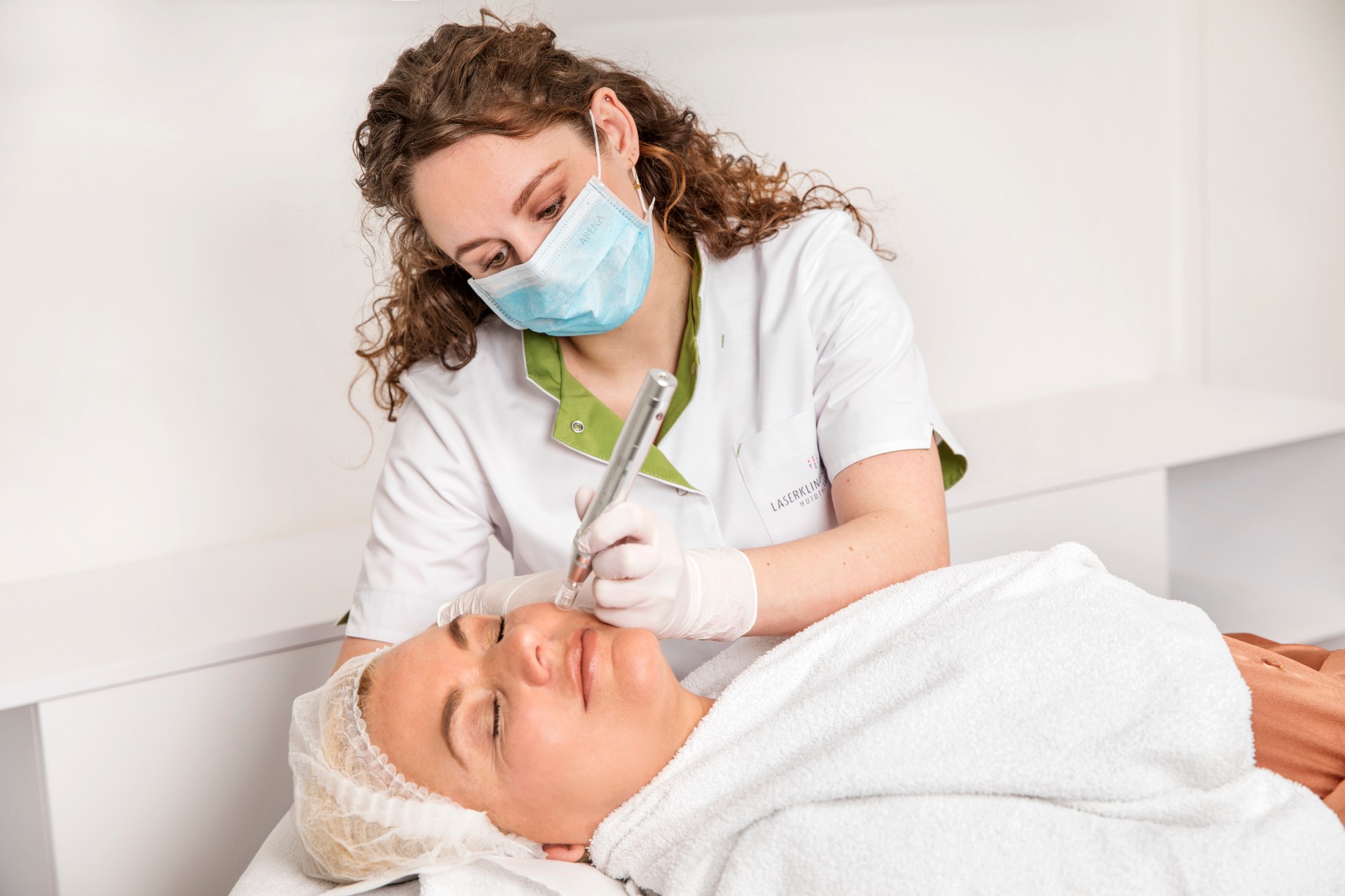 Littekens die ontstaan door acne | Laserkliniek