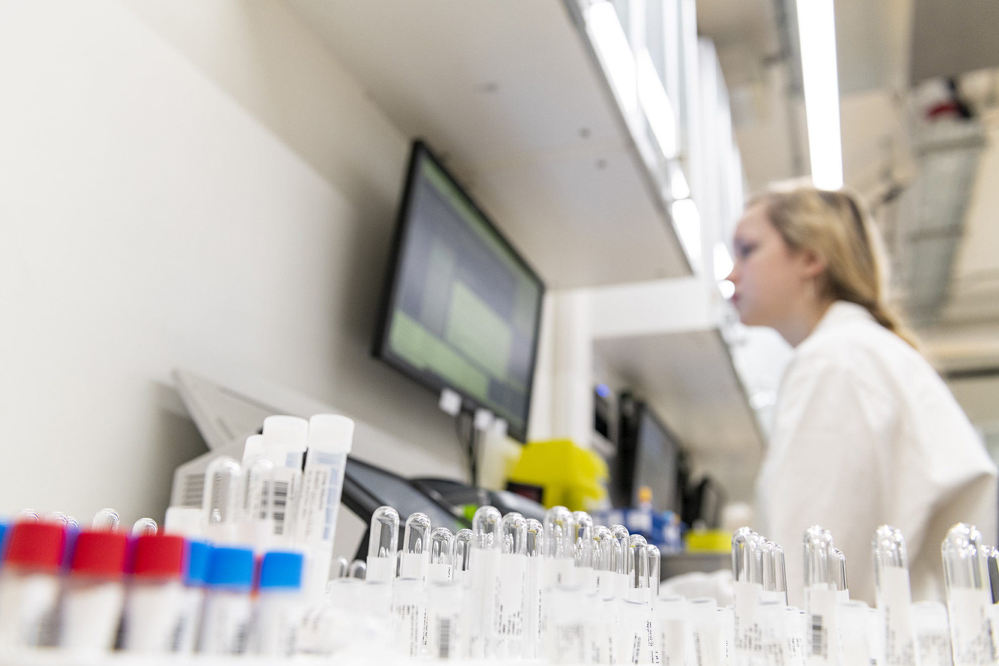 News | Patch for Schizophrenia | Richmond Pharmacology