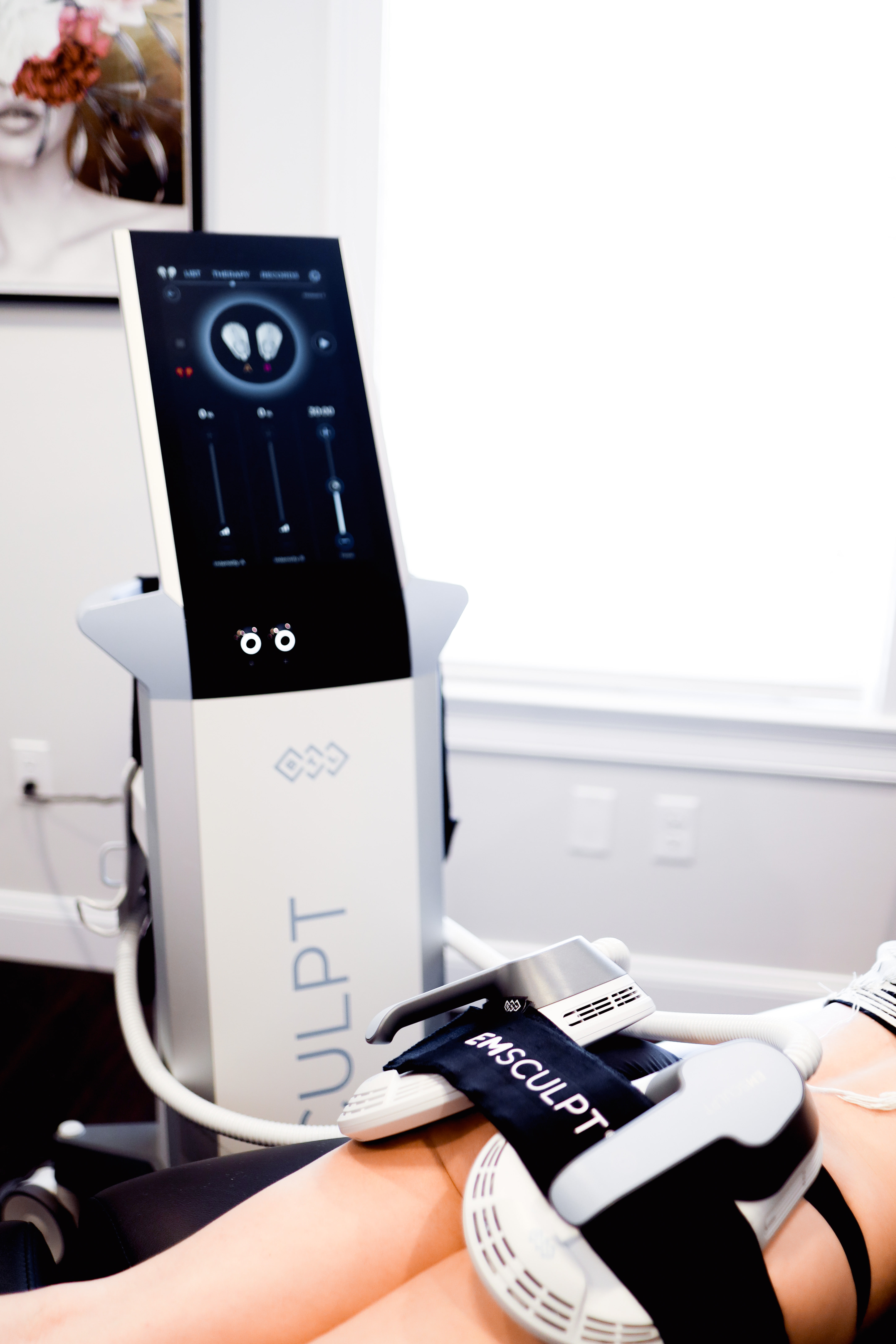 Body Contouring and Muscle Definition with Emsculpt