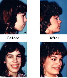 Orthodontics & Jaw Surgery | Busch & Musich Orthodontics