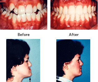 Orthodontics & Jaw Surgery | Busch & Musich Orthodontics