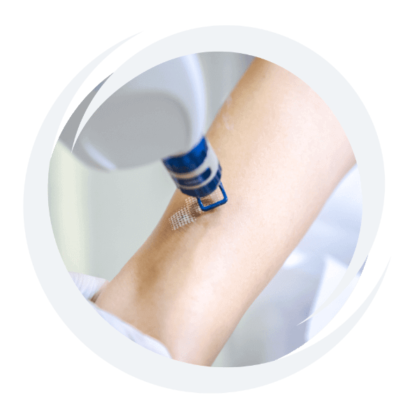 Pixel Laser Resurfacing | Este Medical Group