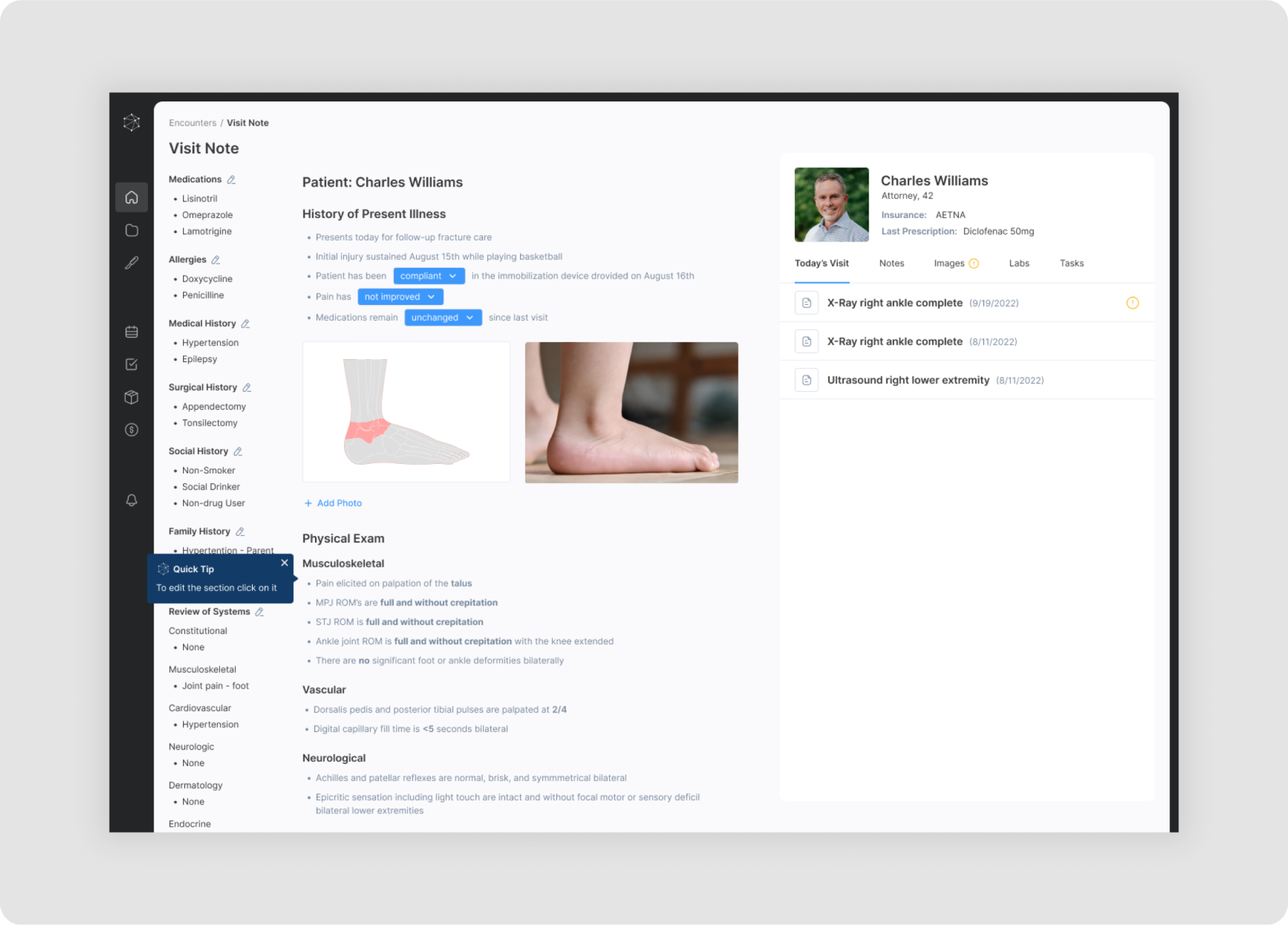 Populate Design Case Study – Eleken