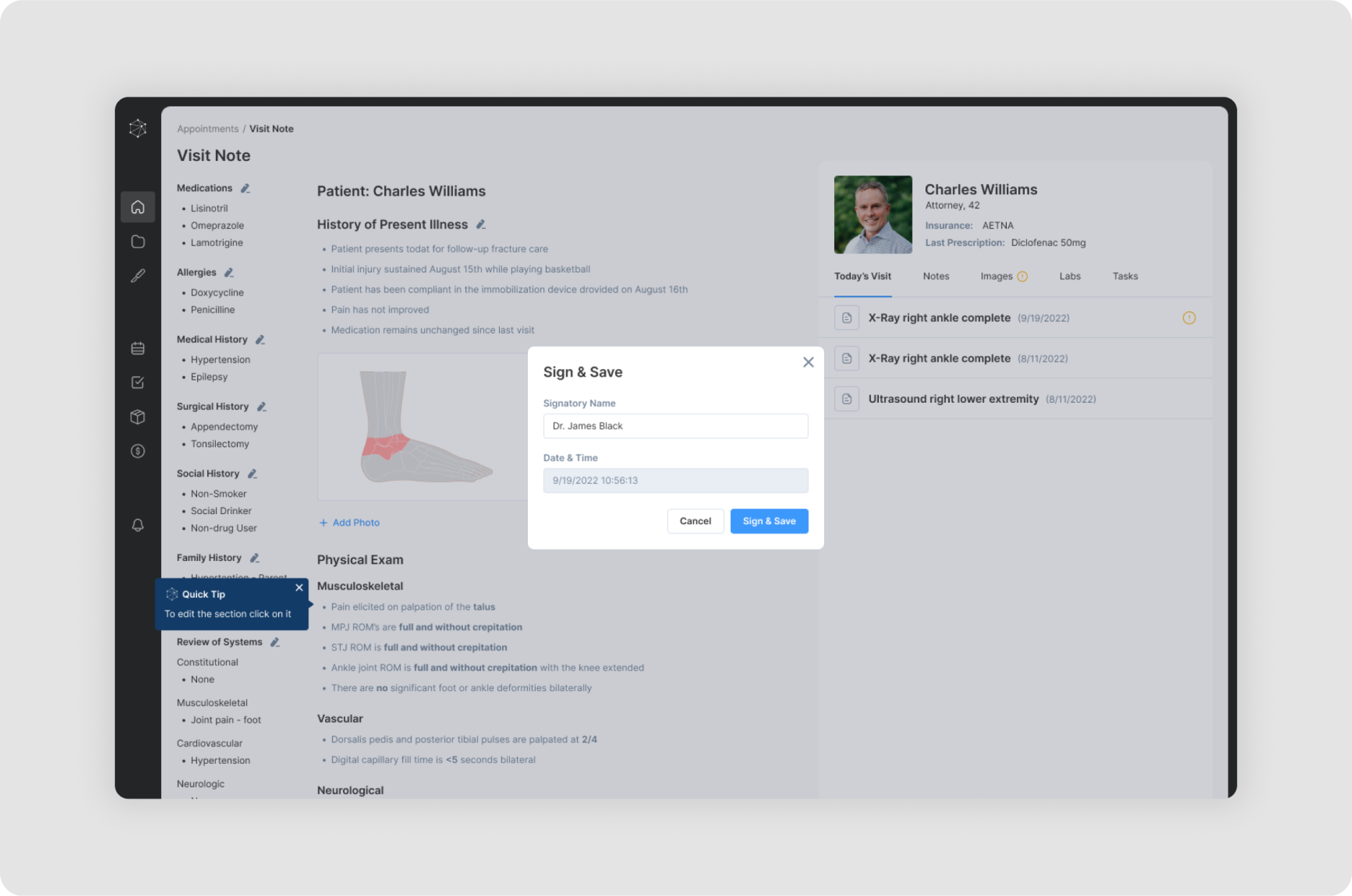 Populate Design Case Study – Eleken