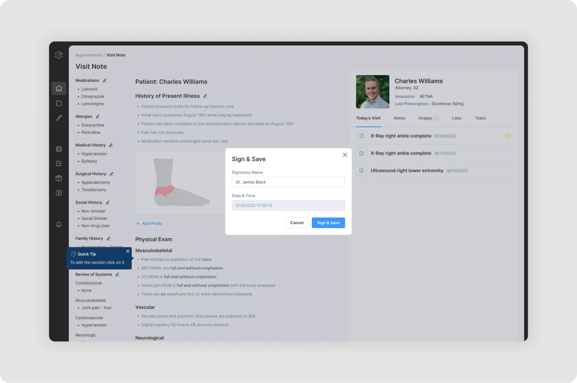 Populate Design Case Study – Eleken