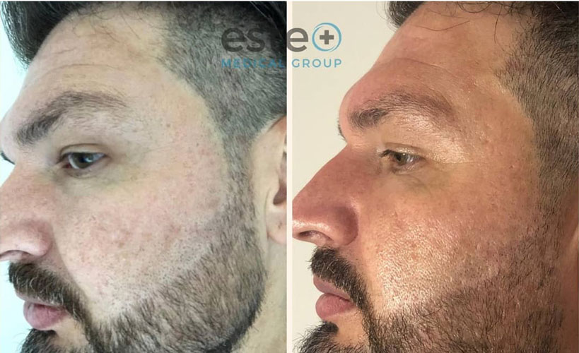 Dry Skin | Causes & Treatment for Xeroderma – Este Medical Group