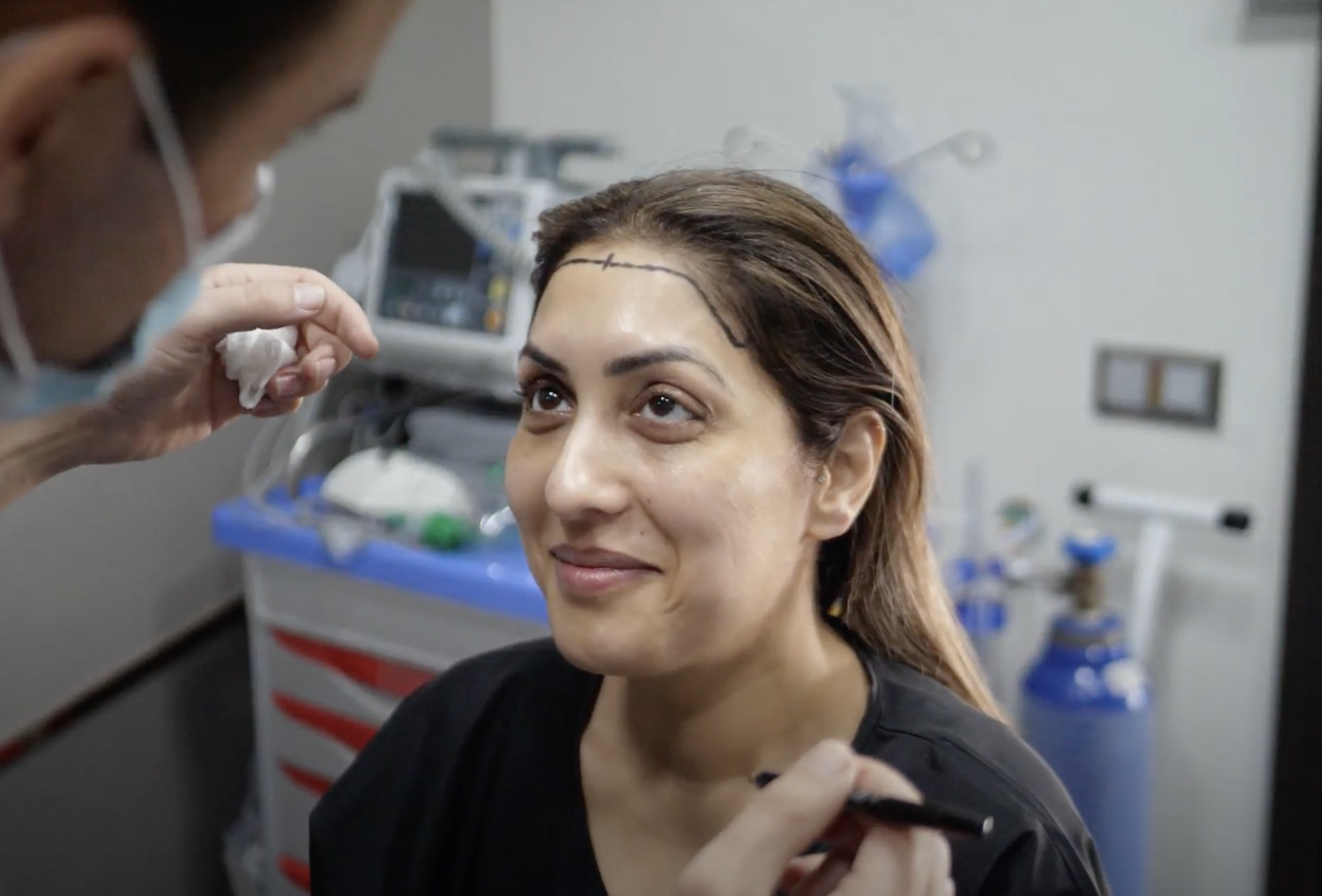 Samra Has ‘Invisible’ Female Hair Transplant & Nose Filler - Este