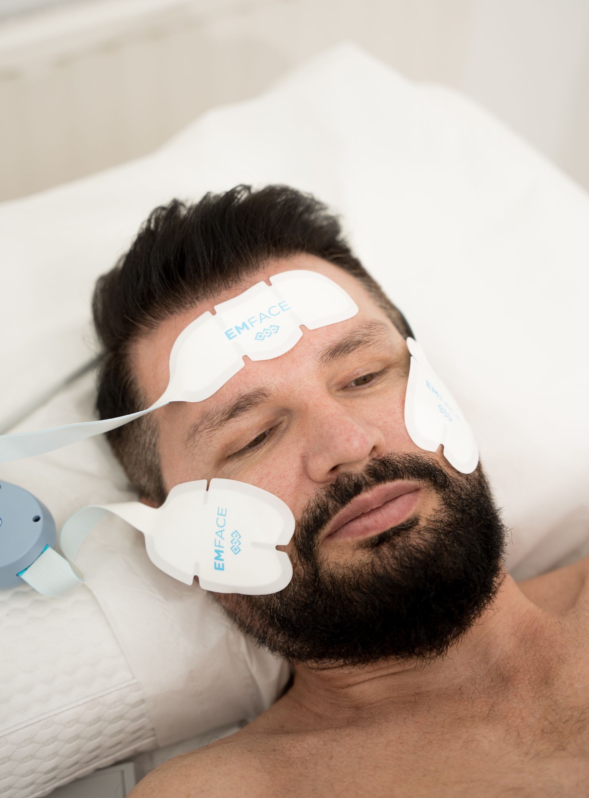 Stretch Mark Camouflage Treatment - Este Medical Group