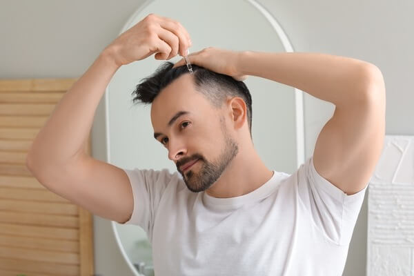 Is It Possible To Regrow Hair Without Hair Transplant? - Este