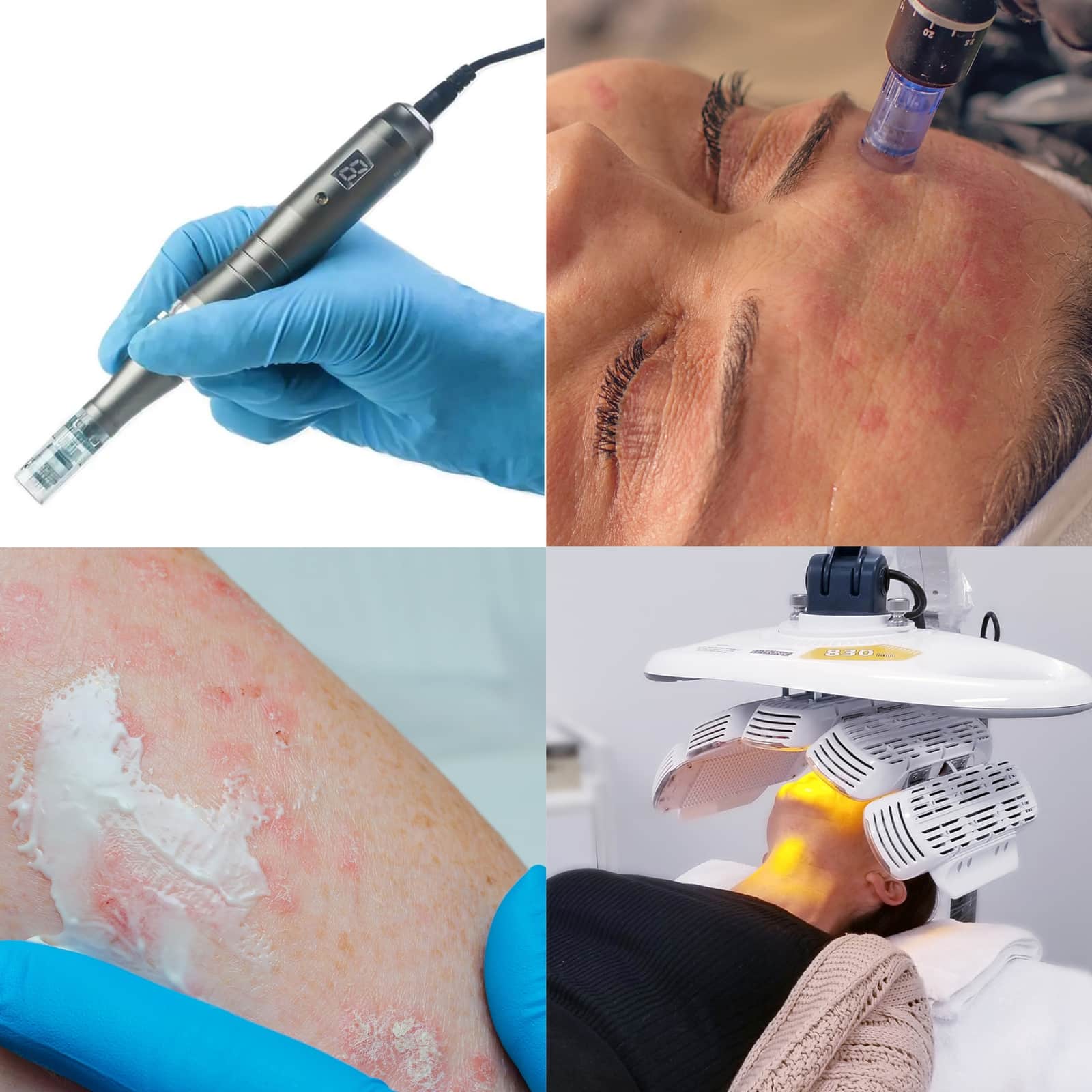 Aftercare: How to manage dressings, wounds and surgical sites | Spot ...