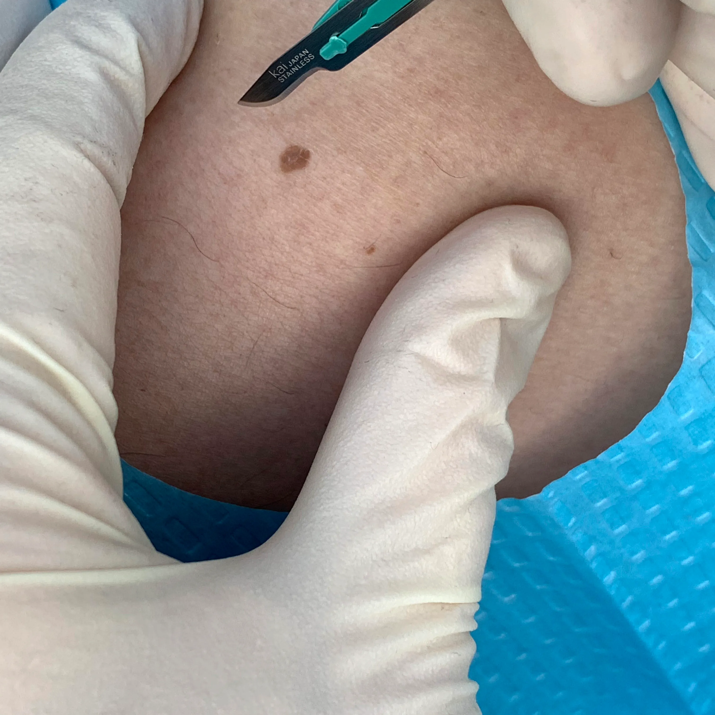 Spot Check: skin cancer + aesthetics. Melbourne CBD.