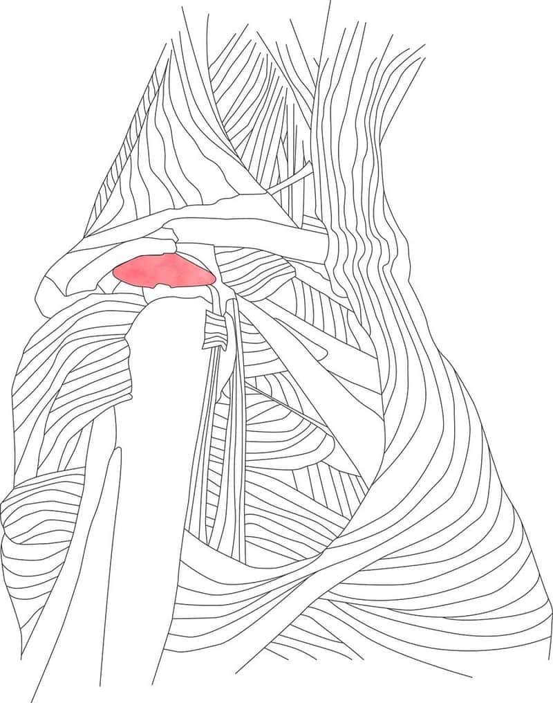 Subacromial Bursitis - Shoulder Clinic