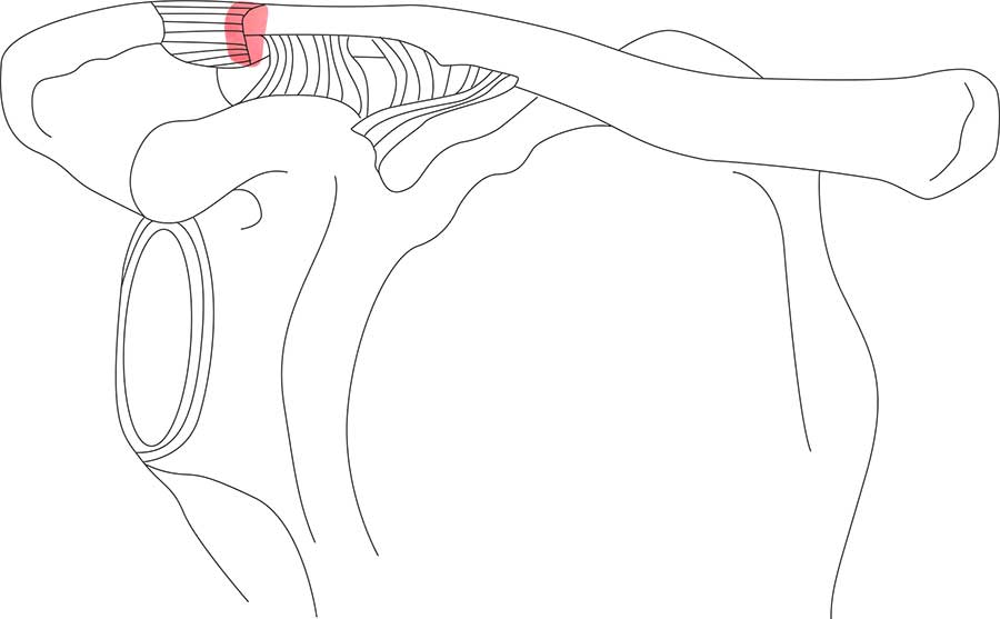 Shoulder Surgery - Shoulder Clinic
