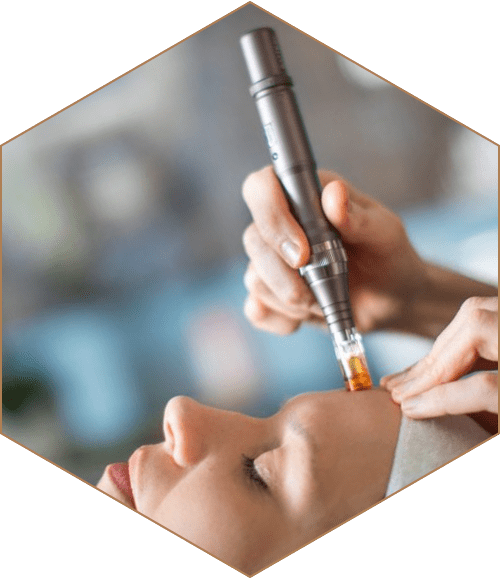 Nanofusion Treatments