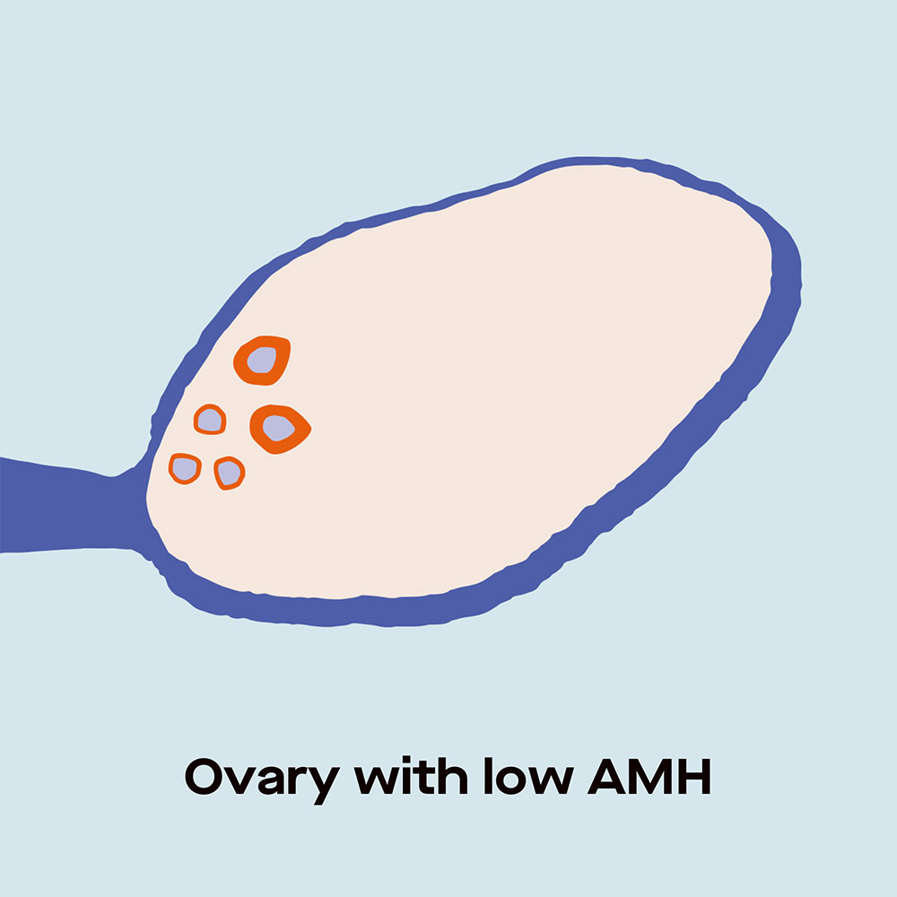 AMH Levels By Age Charts And Fertility Implications amh-levels-by-age-charts-and-fertility-implications