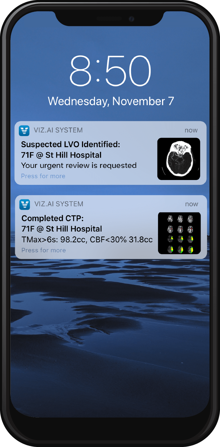 Viz.ai Intelligent Care Coordination