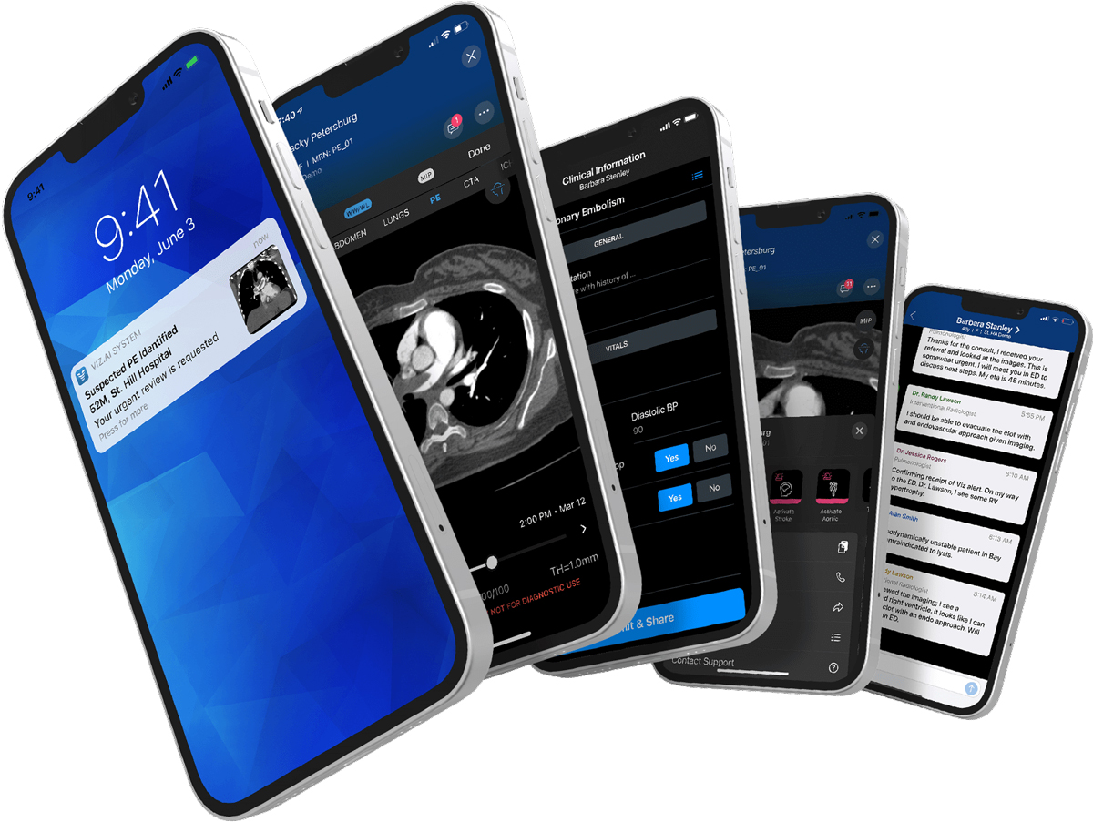 Viz.ai Pulmonary Embolism