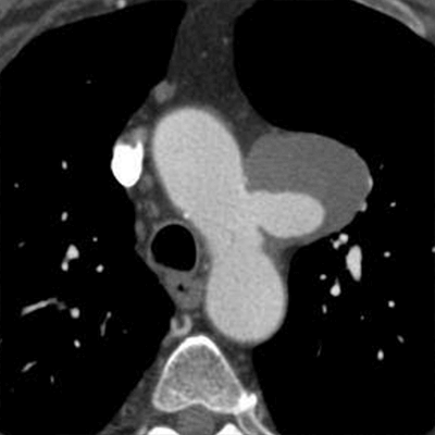 Viz™ AORTIC - Hyperfast image access at your fingertips