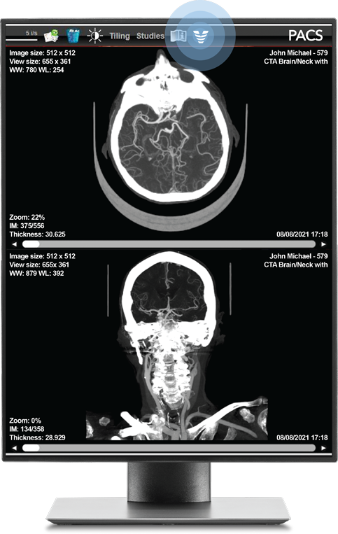 Viz™ Radiology Suite