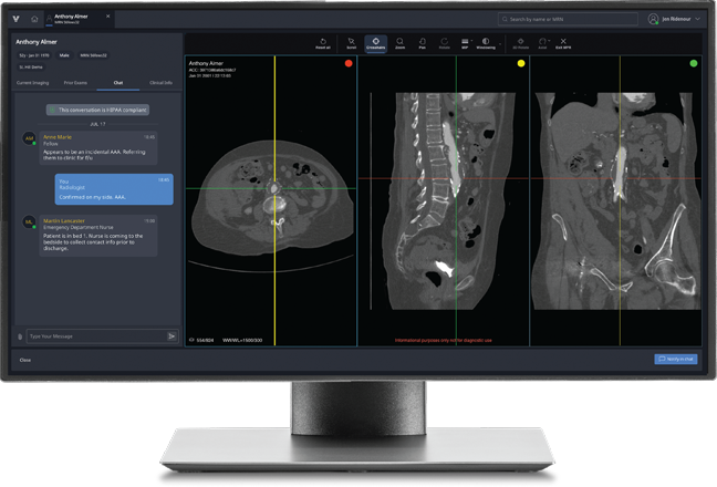 Viz™ Radiology Suite