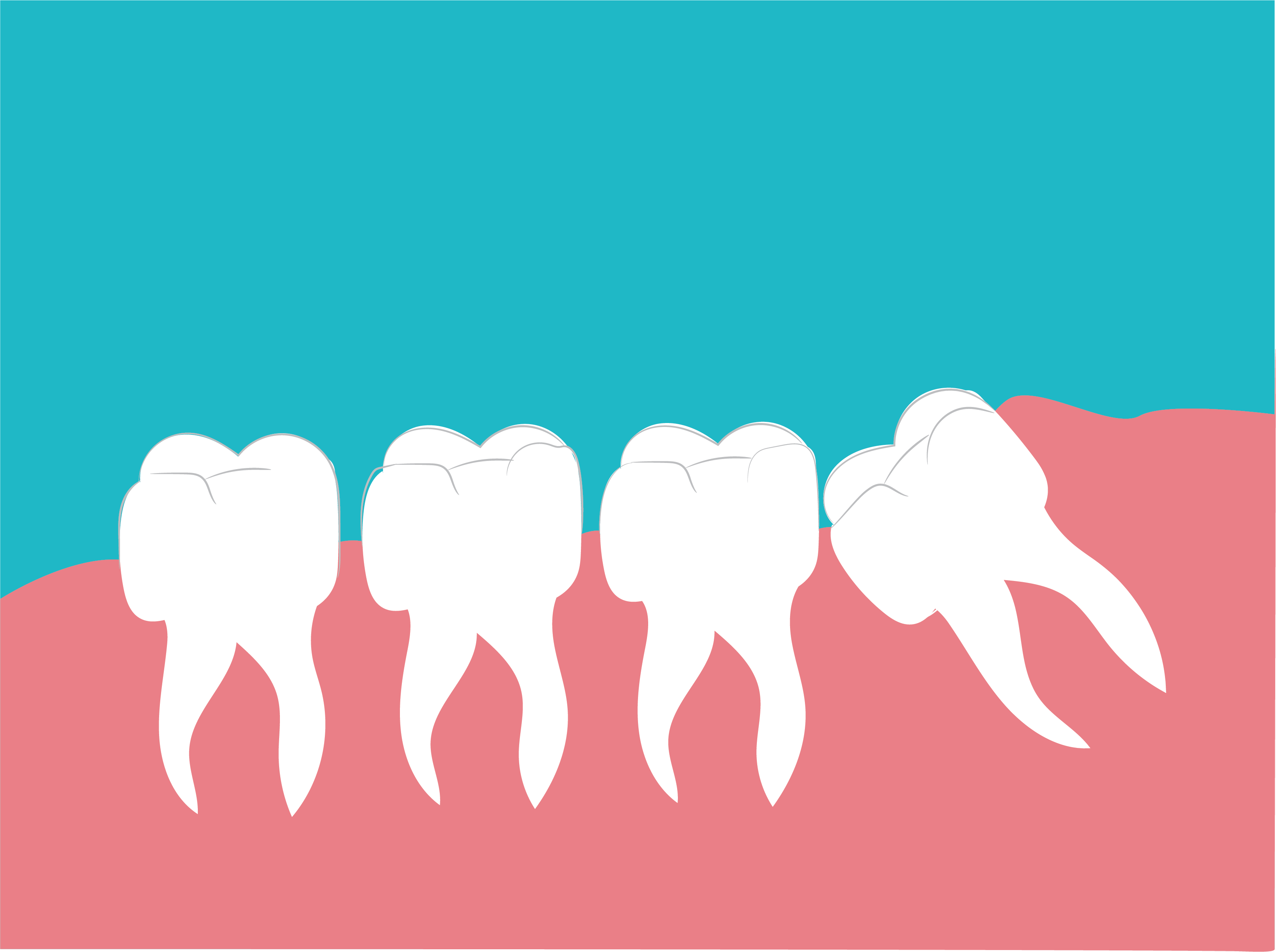 Q: Why are some people born without wisdom teeth? | Dental Image ...