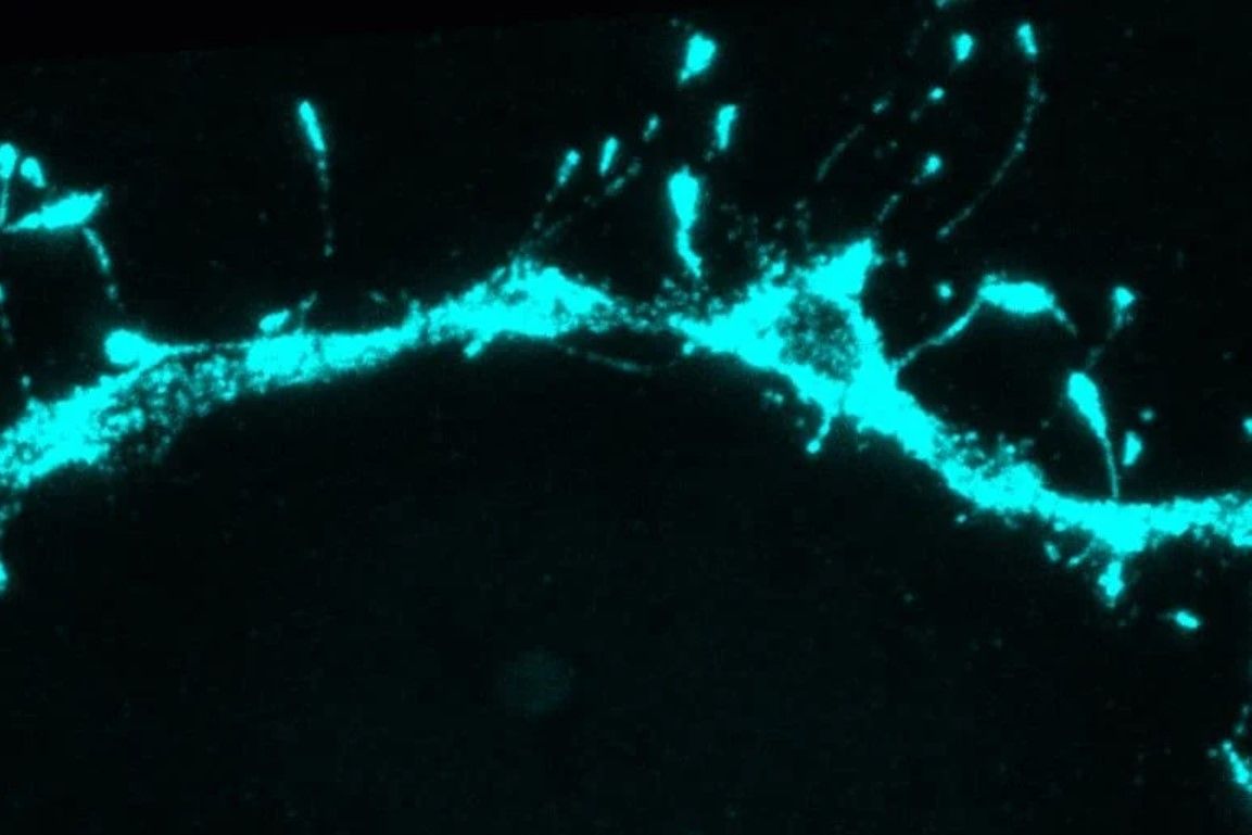 Blog - 7 Big Neuroscience Breakthroughs in 2022