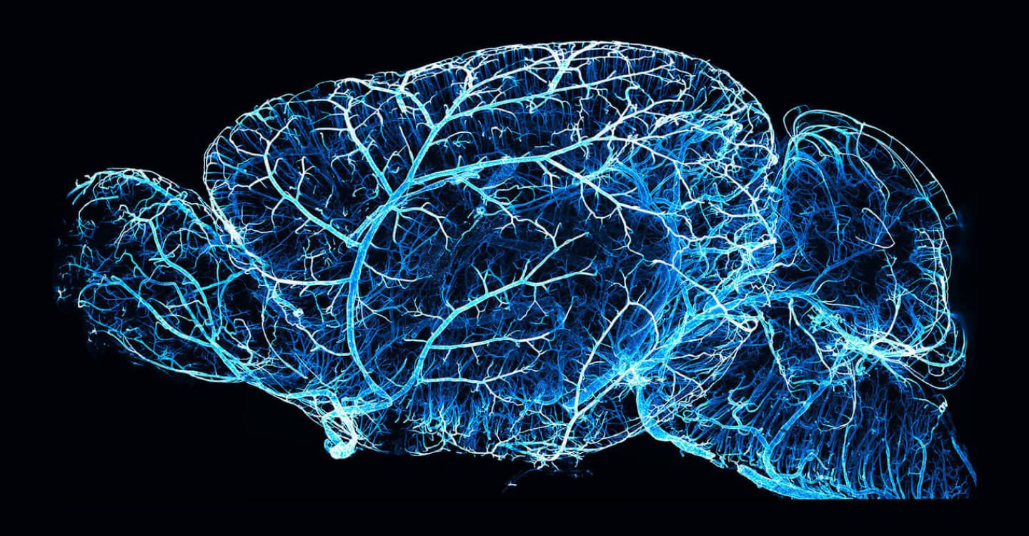 Universal Tissue Clearing Kit | Straightforward iDISCO-Based Clearing