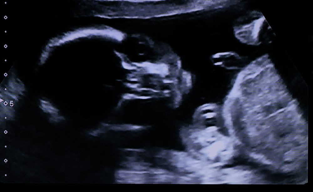 19 week baby size - It's the 19th week - Your baby now of a size of ...