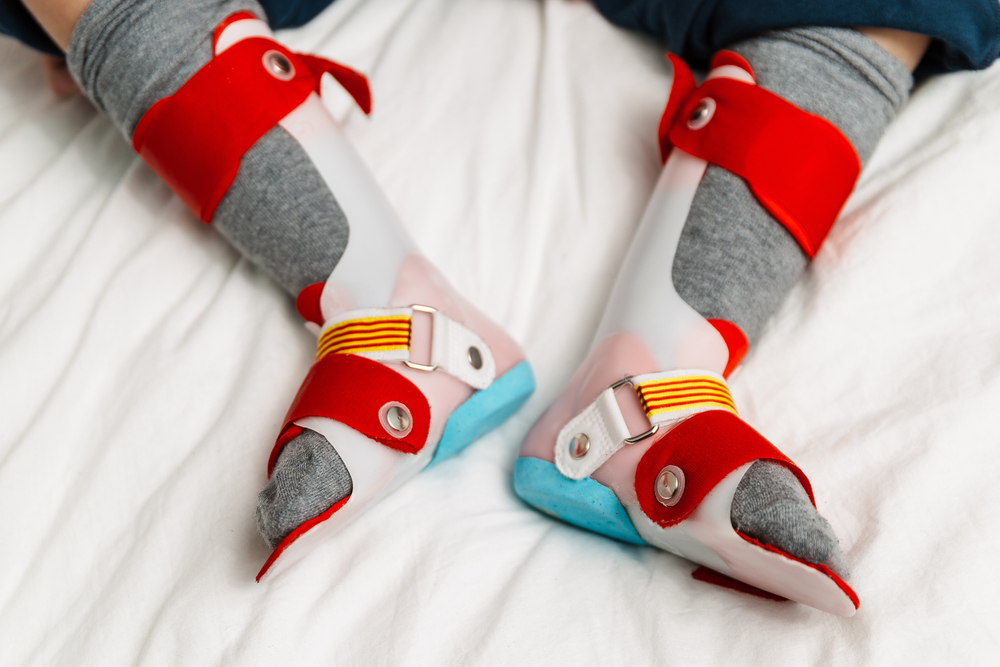Role of Physiotherapy in helping children with Duchenne’s muscular ...