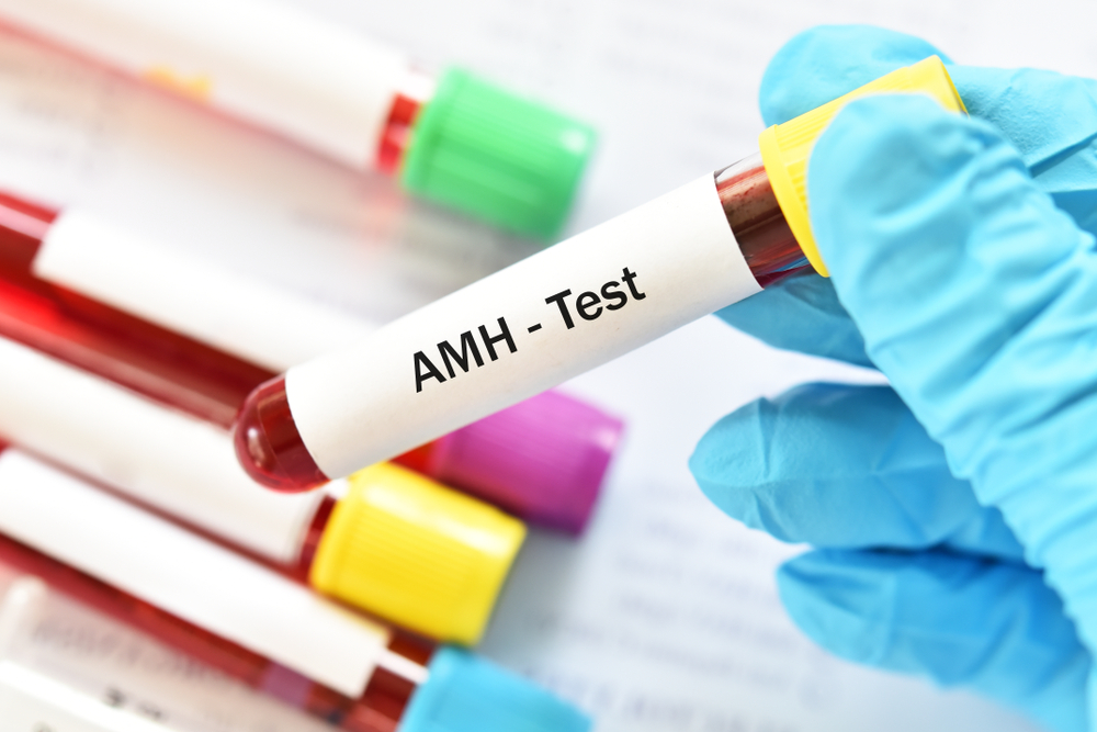 What is AMH - Is AMH Testing Necessary for Women?