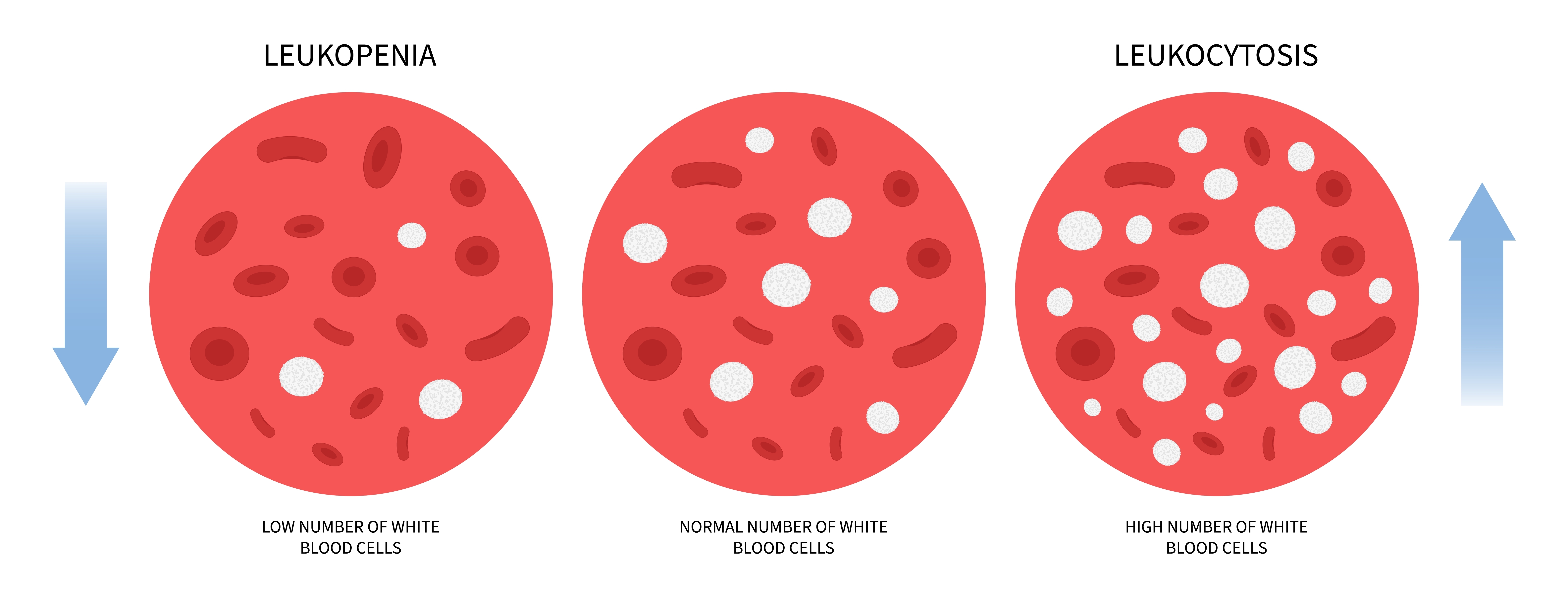 Is A High White Blood Cell Count WBC During Pregnancy Harmful Is A High White Blood Cell Count WBC During Pregnancy Harmful