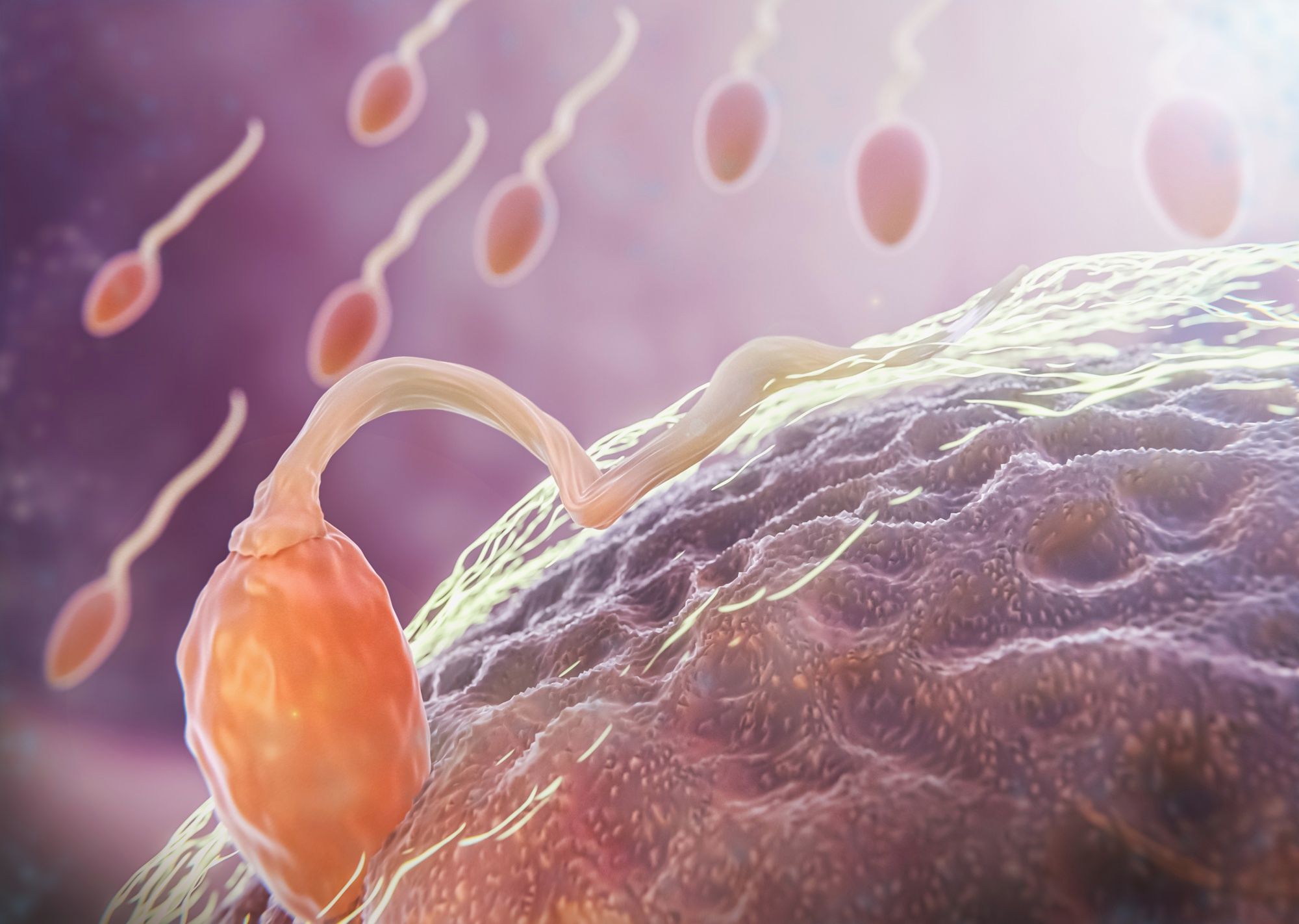 In Vitro Fertilization (IVF) Originated Pregnancies: Understanding the ...