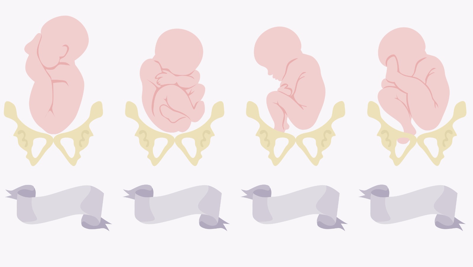 BREECH PREGNANCY: WHAT IS BREECH PREGNANCY?