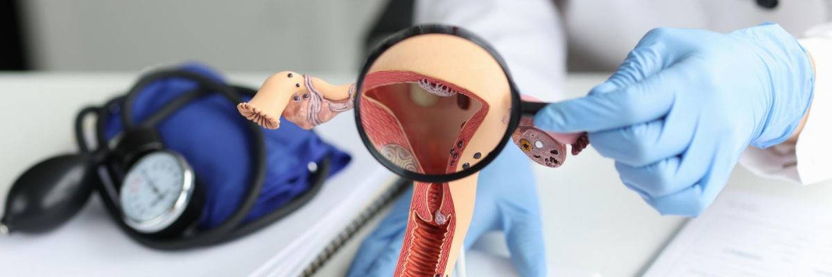 Bacterial Vaginosis (BV): Causes, Symptoms, and Treatment