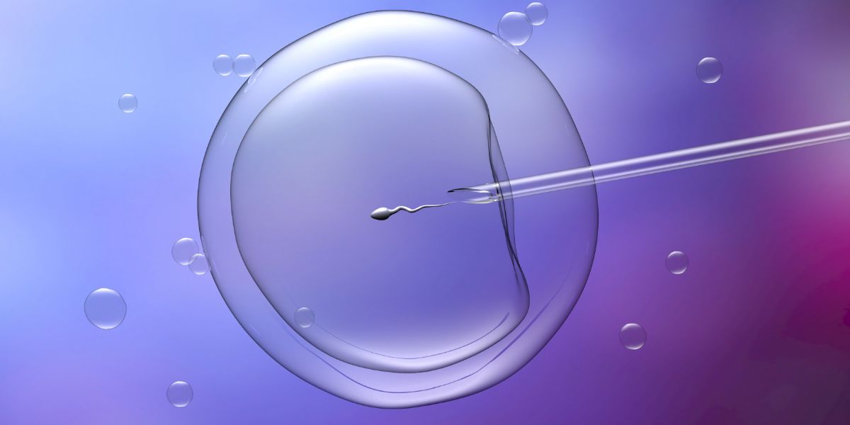 A Detailed Insight on Intracytoplasmic Sperm Injection Treatment