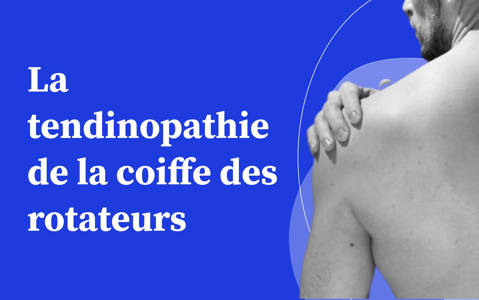 La tendinopathie de la coiffe des rotateurs