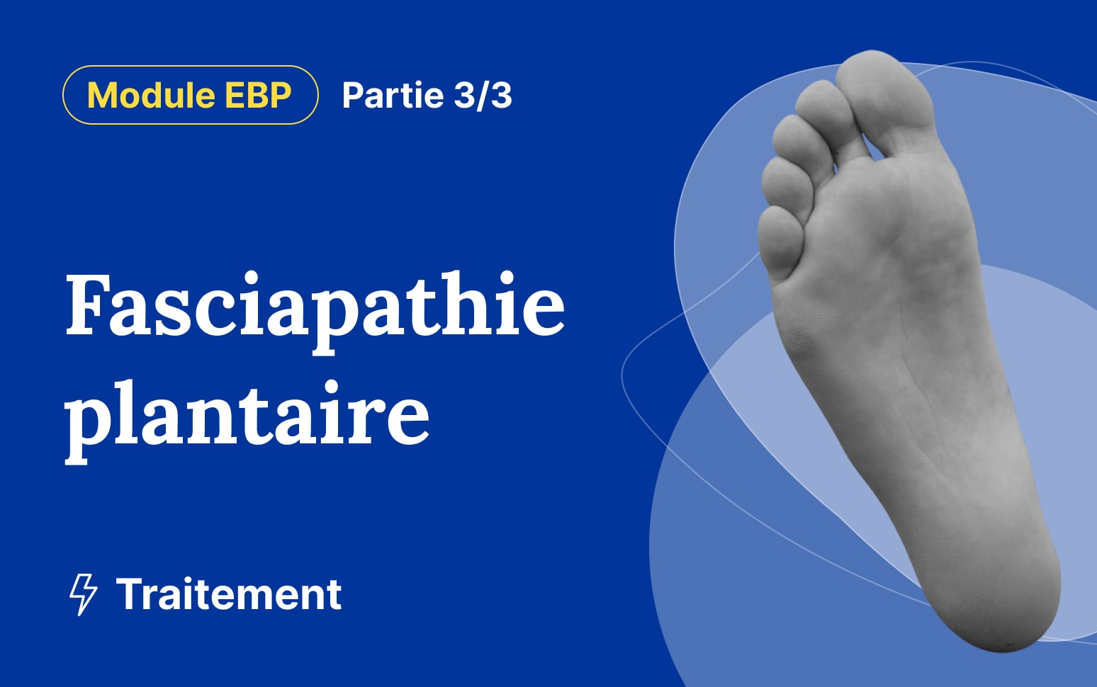 Module - La fasciapathie plantaire - Traitement & Prise en charge
