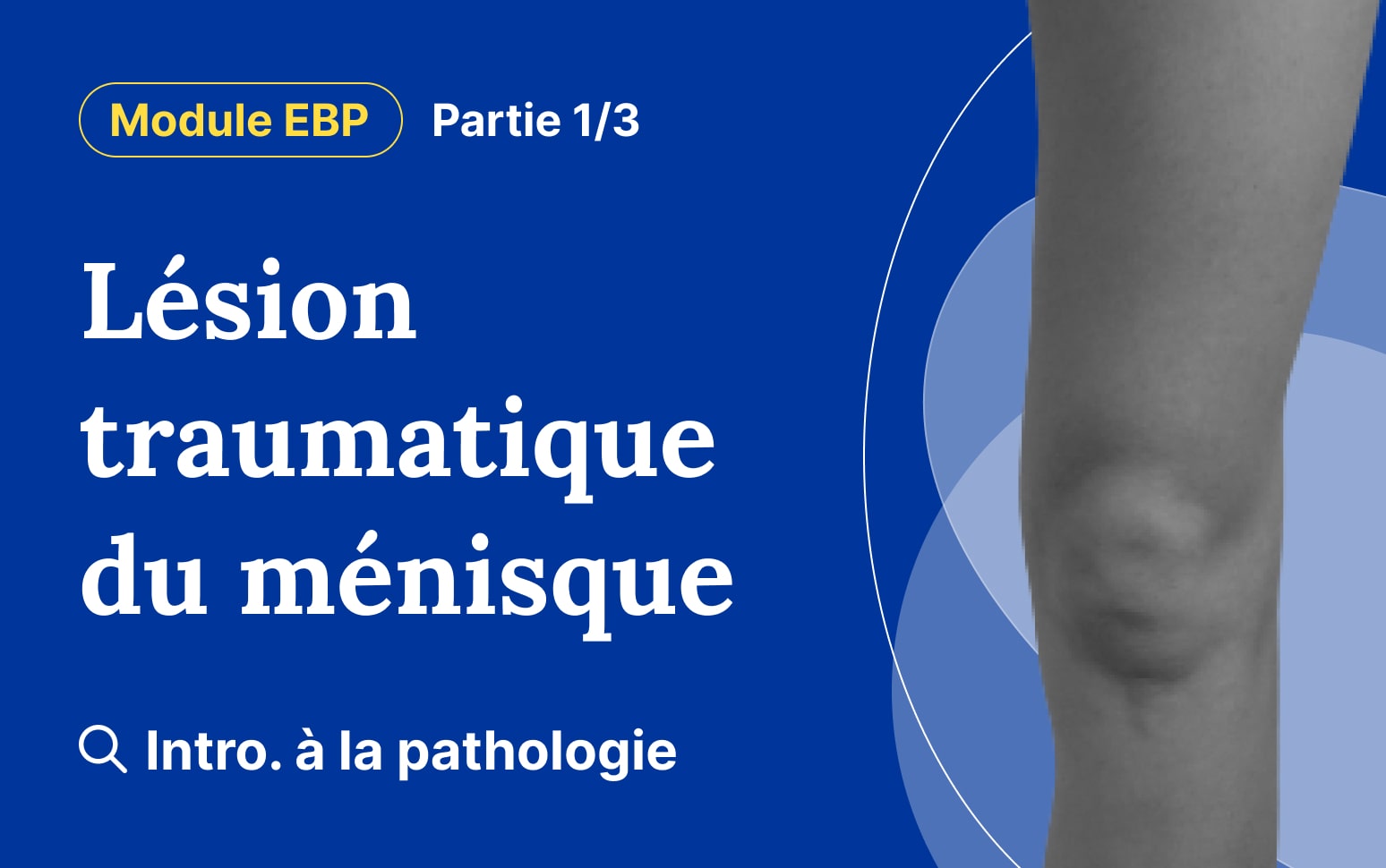 Module - La lésion traumatique du ménisque - Introduction à la pathologie