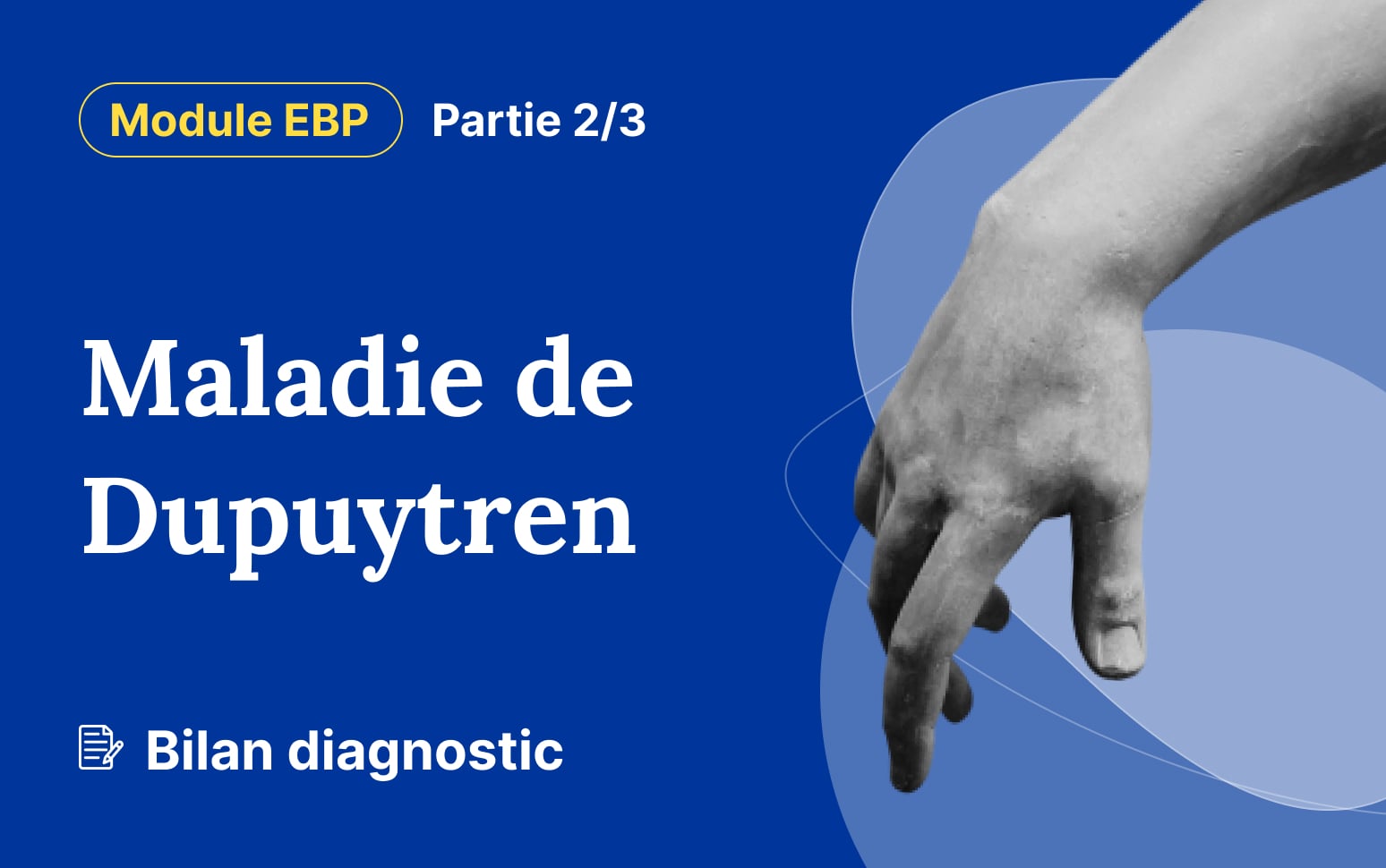 Module - La maladie de Dupuytren - Diagnostic & Bilan