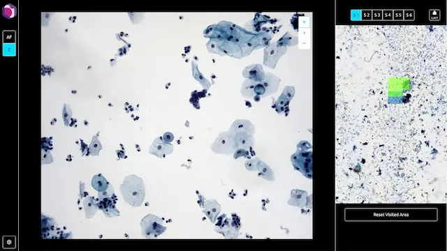 Morpholens 6 slide scanner | Morphle Digital Pathology