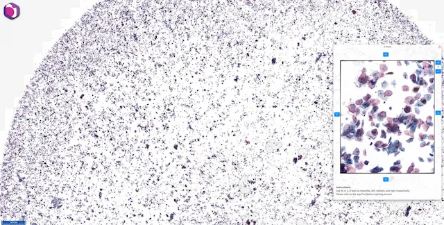 Morpholens 6 slide scanner | Morphle Digital Pathology