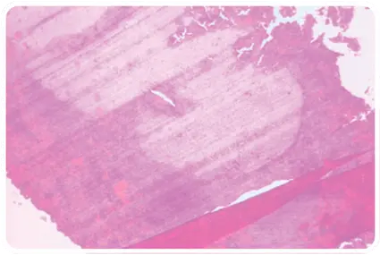Robotome - World’s First Robotic Microtome