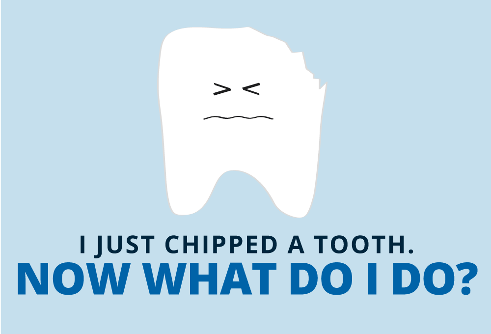 I just chipped a tooth. Now what do I do? | Fargo Dentist