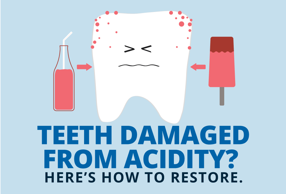 Teeth damaged from acidity? Here’s how to restore. | Fargo Dentist