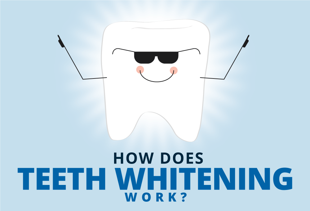 How does whitening your teeth work? | Fargo Dentist