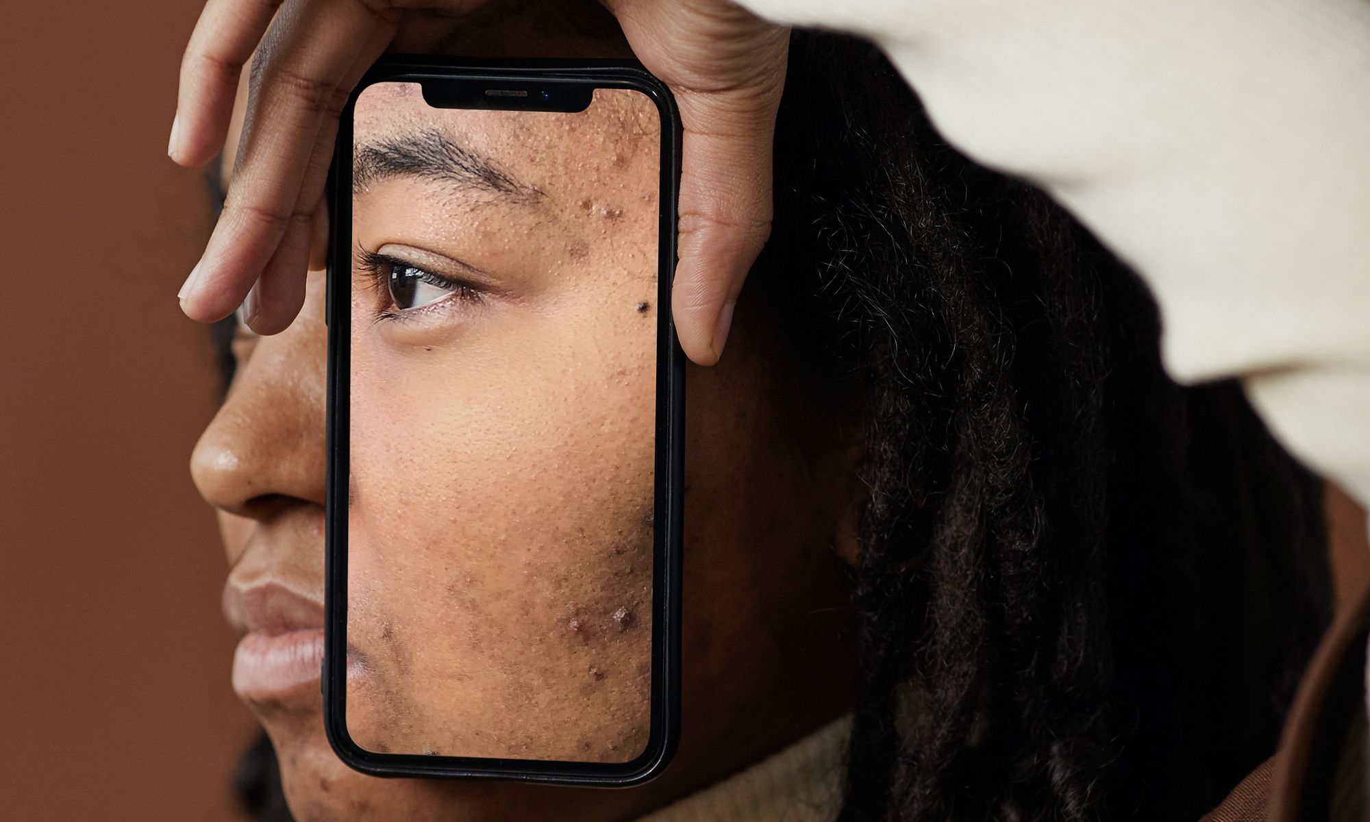 Acne Face Mapping: What Your Pimple Location Could Mean | Software