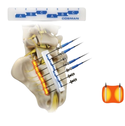 Palisade™ Guideblock