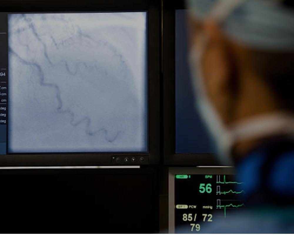 What to Expect In an Angiogram Procedure | Blog | South Valley Vascular