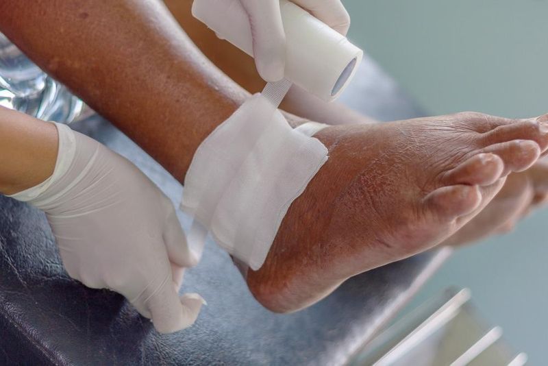 Wound Maceration Management | Wound Maceration Prevention