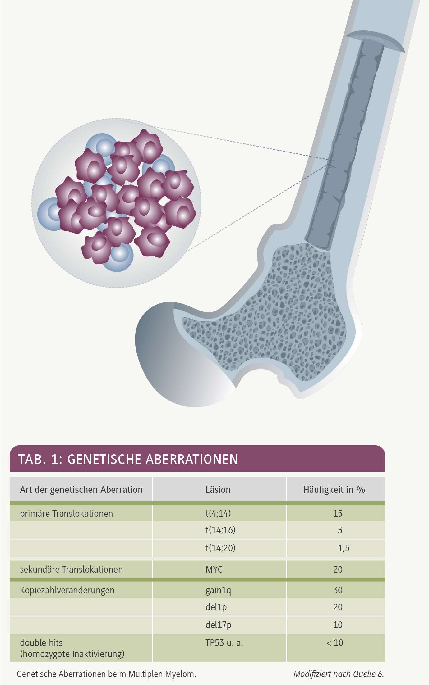 Neue Konzepte beim Multiplen Myelom